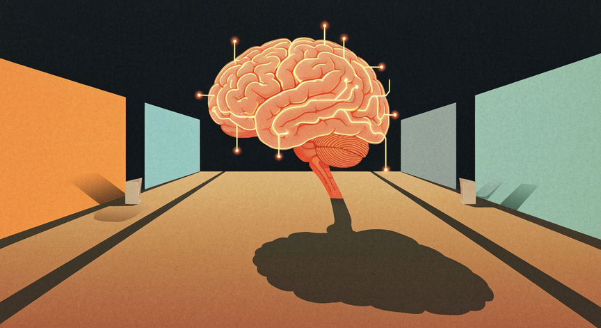 Visual Processing and Visual Snow Syndrome