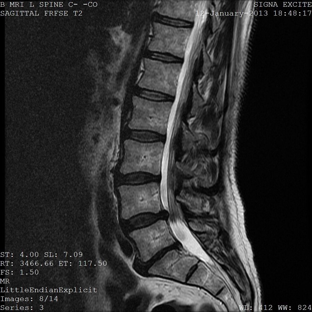 Common Causes of Lower Back and Pelvic Pain - Reclaim Your Back ...