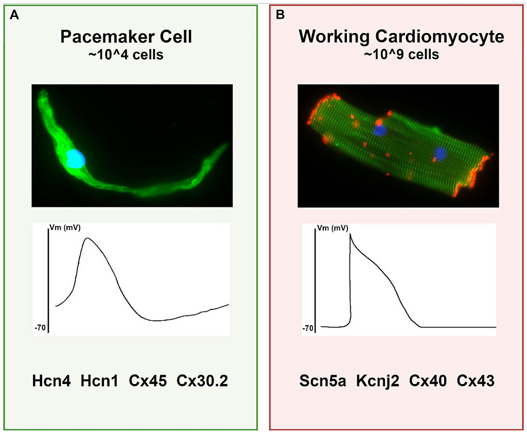 SA Node Electrophysiology - SA and AV Node Electrophysiology Deep Dive ...